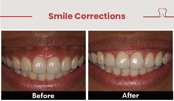 Best Smile Design Dental Clinic in Lucknow